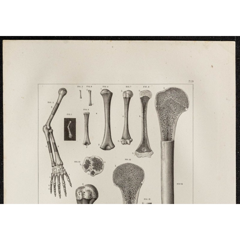 1864 - Bras et Humérus