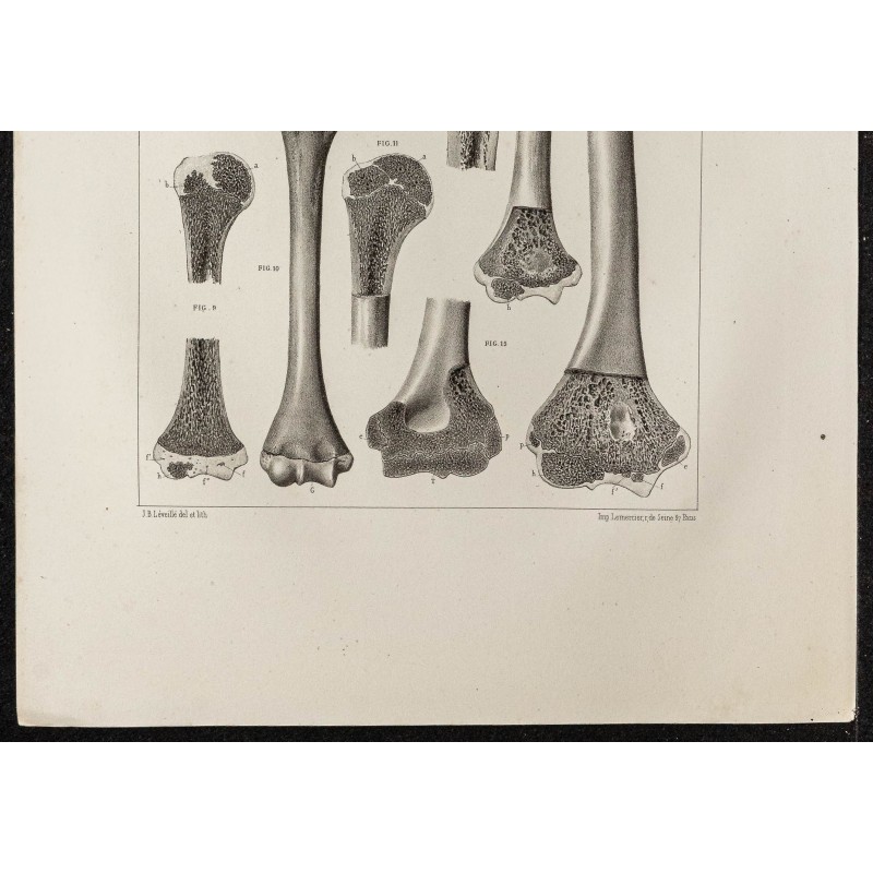 1864 - Bras et Humérus