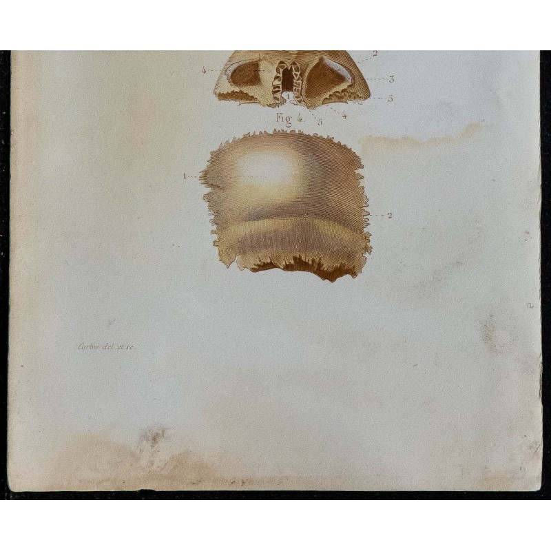 1852 - Os frontal et pariétal crâne