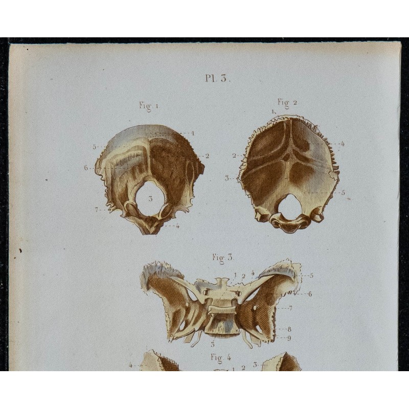 1852 - Os occipital sphénoïde temporal crâne